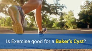 Is Exercise good for a Baker’s Cyst? - OSMO Patch US
